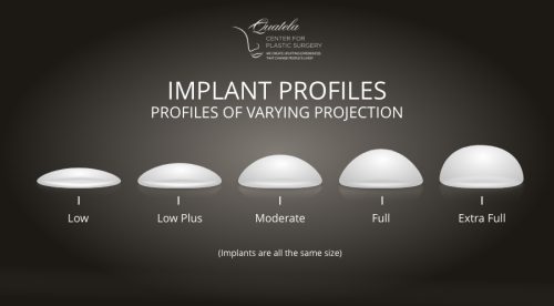 Different Types of Breast Implants & More: What You Should Know About ...